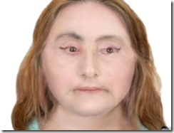 First U.S. Face Transplant Patient Talks on Camera from the Cleveland ...